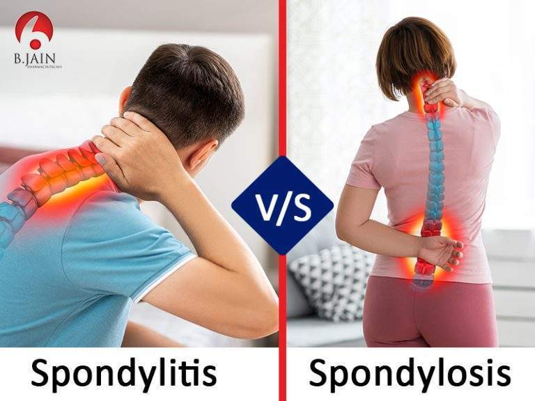 Back Pain – Symptoms, Causes and Treatment | BJain Pharma